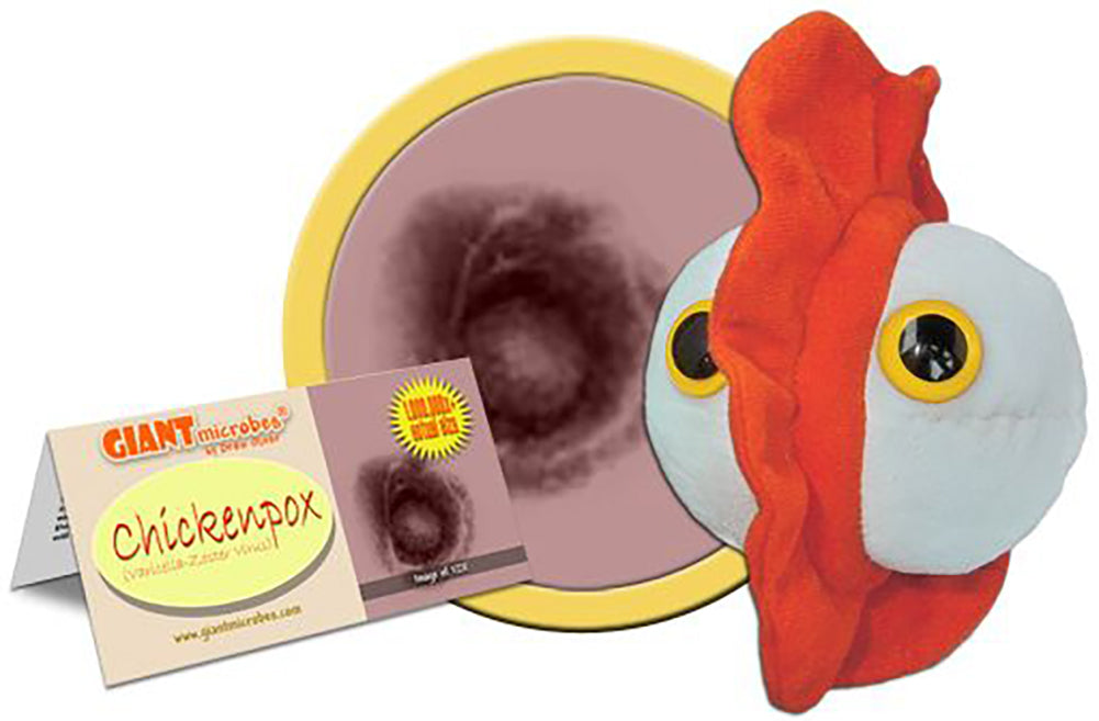 Giant Microbes Plush - Chickenpox (Varicella-Zoster Virus) – Knick ...